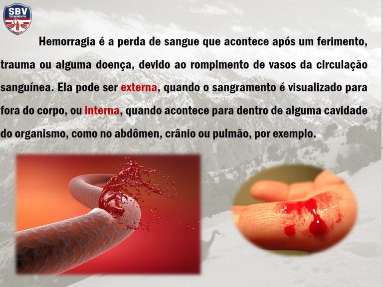 Controle de Hemorragia SlideShow - Suporte Básico de Vida
